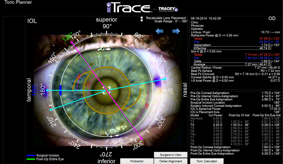 Technology - Hughes Eye Group